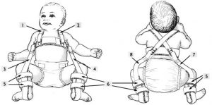 Pavlik Harness Tips For Parents - International Hip Dysplasia Institute