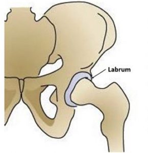 Adolescents - International Hip Dysplasia Institute
